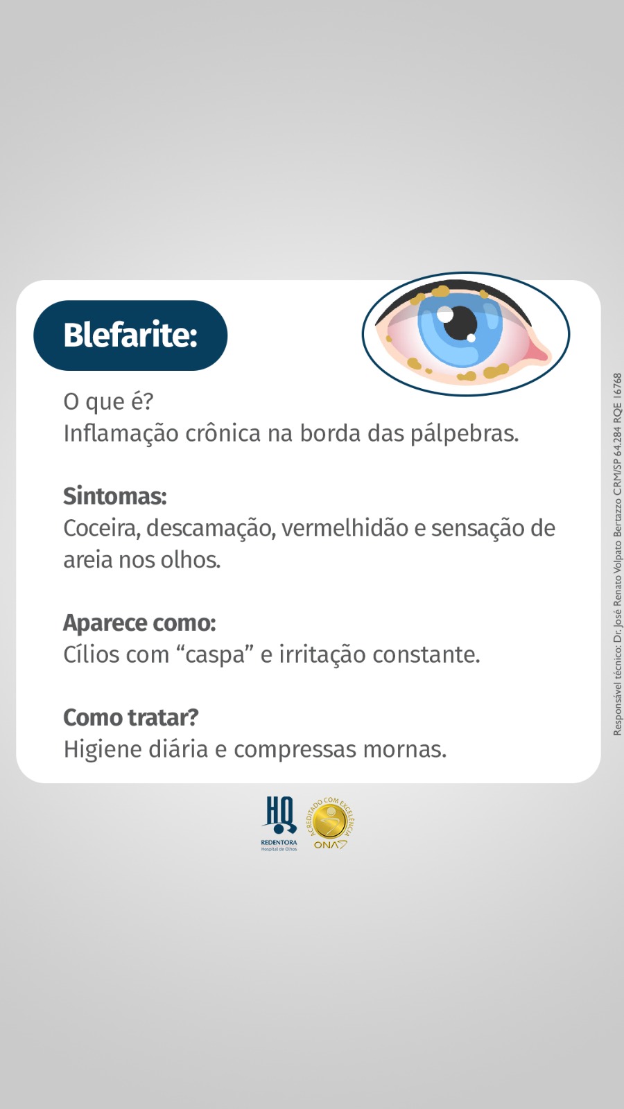 Blefarite, Hordéolo, e Calázio: Parecem iguais, mas não são! Descubra a ...